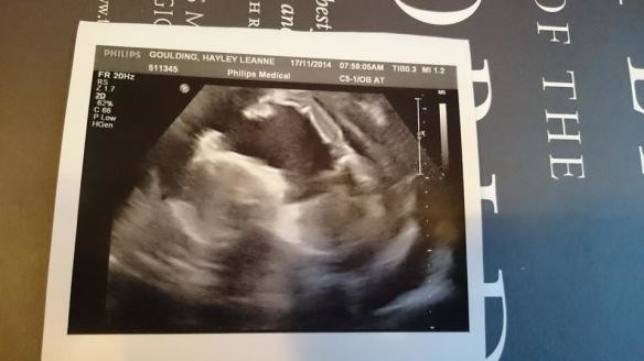 Share your 20 week scan photos.