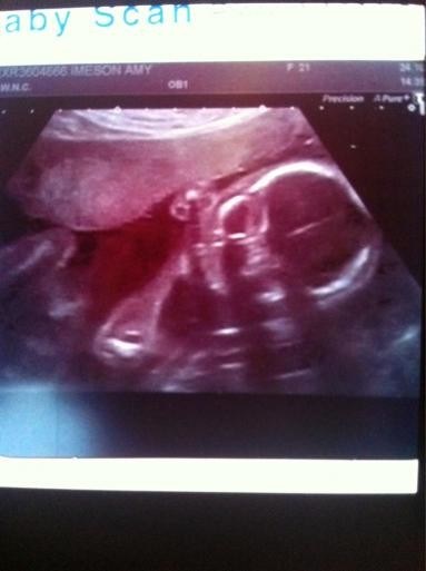 Share your 20 week scan photos.