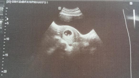 6 week scan!!