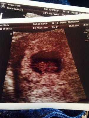 8 week scan