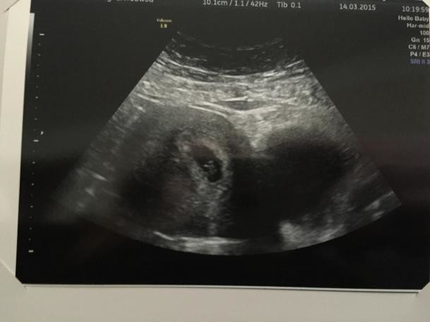 your early scan pics at 8 weeks