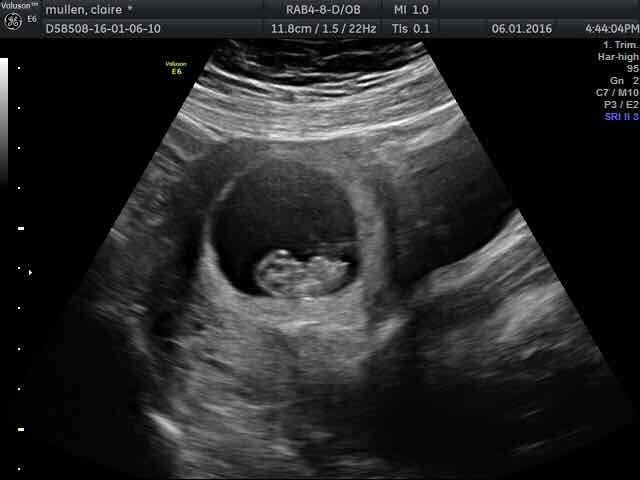 7 week 2 days pregnant