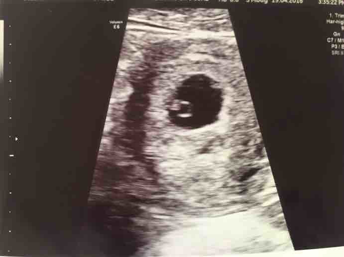 7 week 2 days pregnant