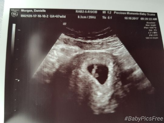 Early Scan 7 weeks today