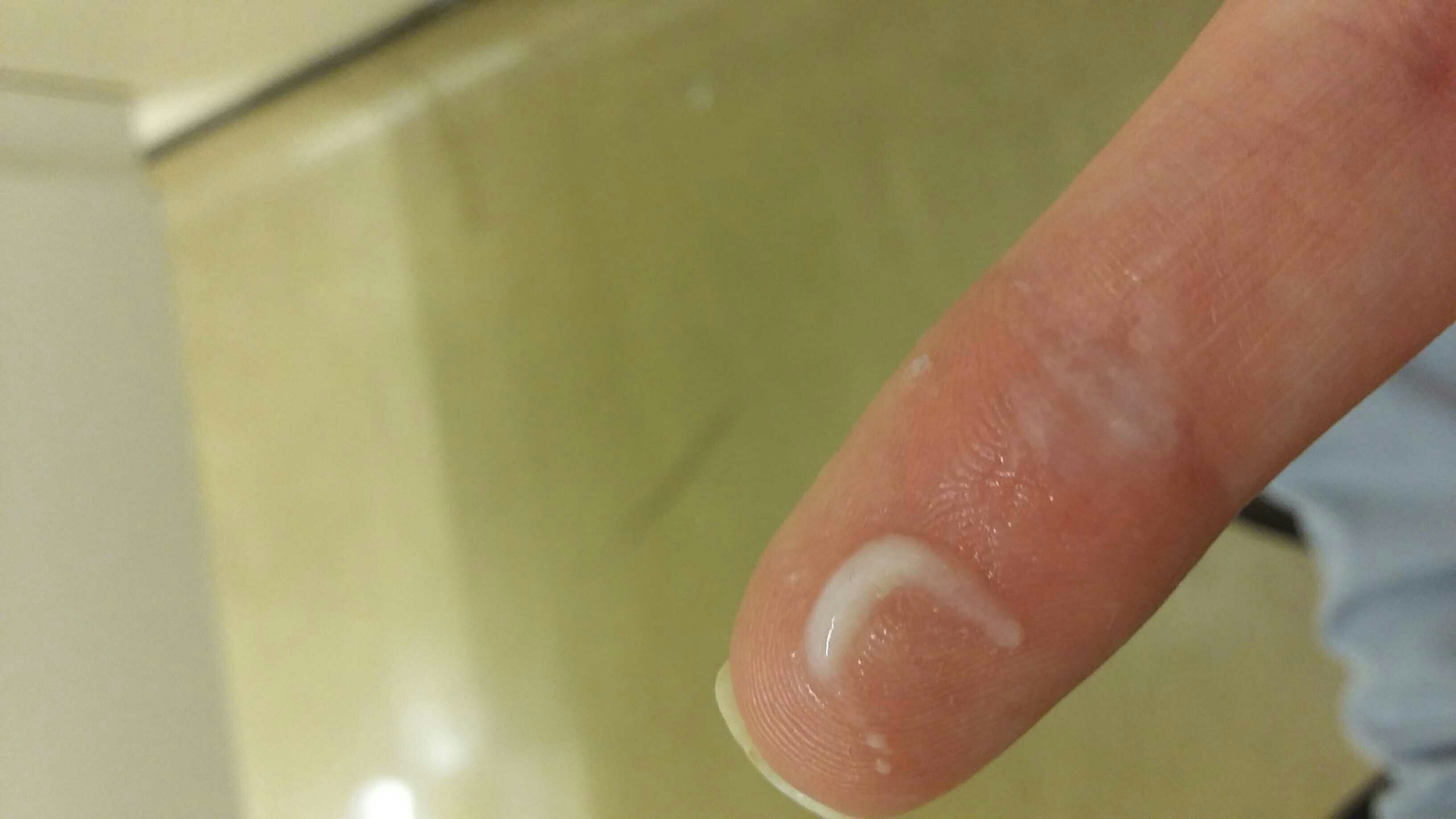 Type of cm photo uploaded