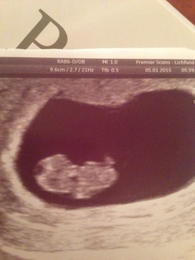 8 week scan pic!!