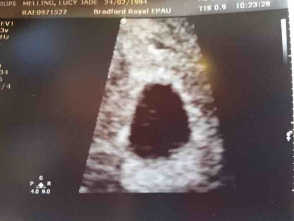 Early scan (8 weeks) - Page: 2