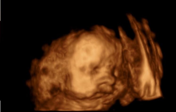 What week should i have a 4D scan?