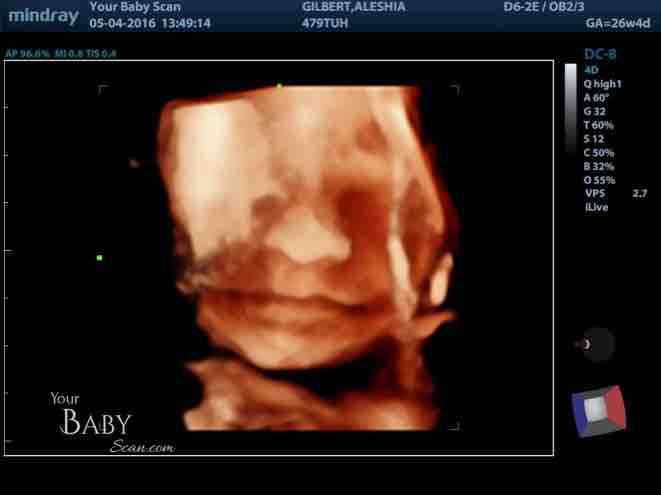 My gorgeous boys 4D scan at 28 weeks x