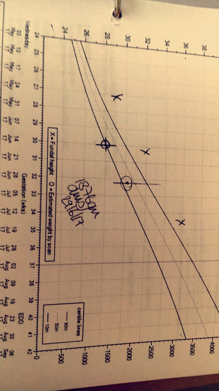 Fundal height measurement