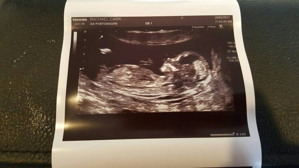 13 weeks scan, guesses welcome!