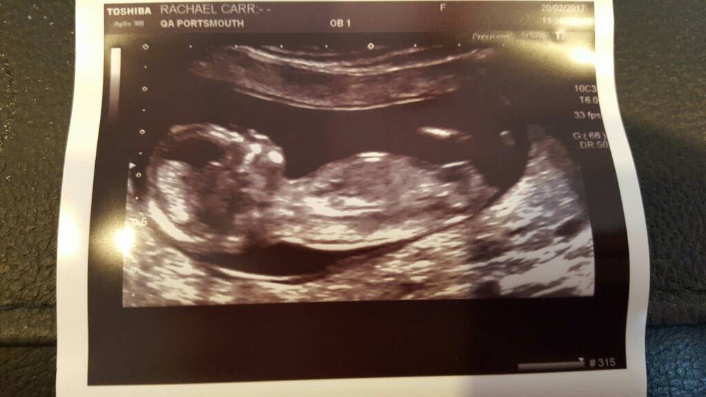 13 weeks scan, guesses welcome!