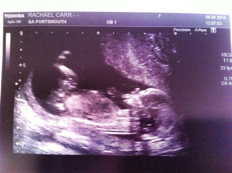 13 weeks scan, guesses welcome!