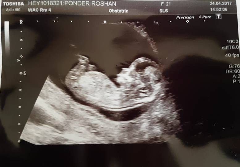 12 week scan gender guess!