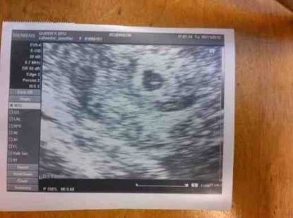 Just had a scan at the EPU