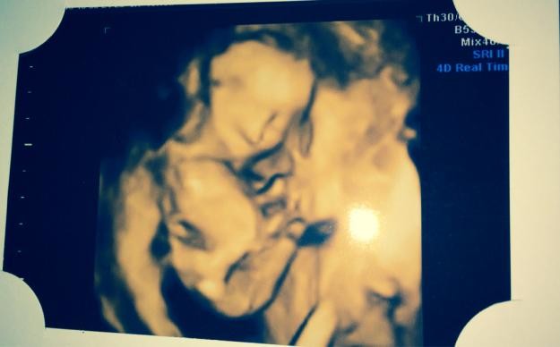 just booked a 16 week gender scan..