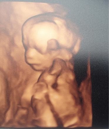 just booked a 16 week gender scan..