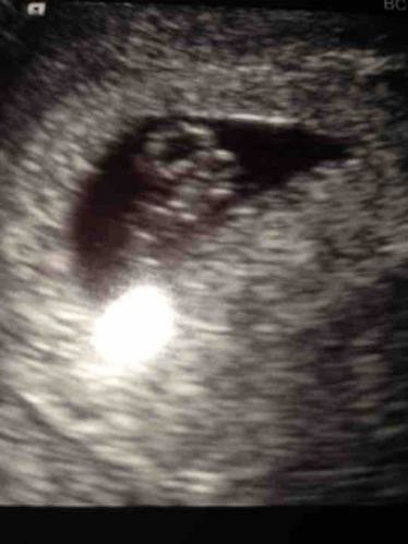 What's the earliest you can see a baby on a scan?