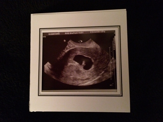 Early reassurance scan at 6+6