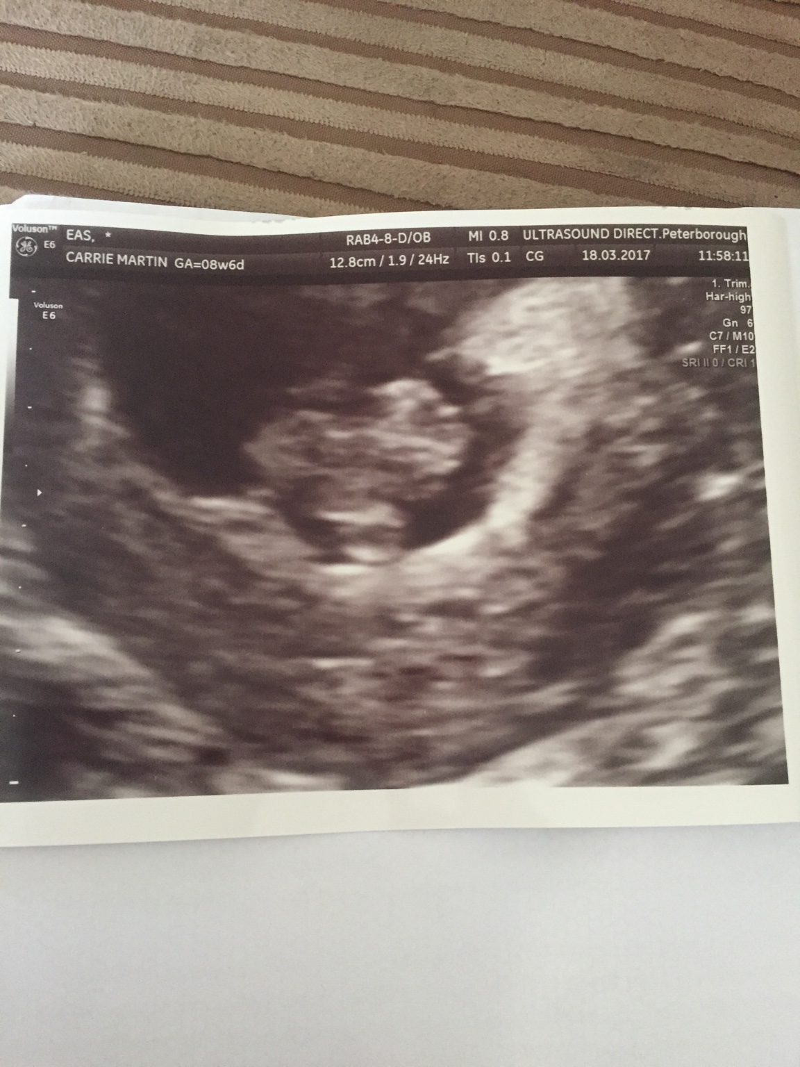 Anyone else got an 8 week scan to compare?
