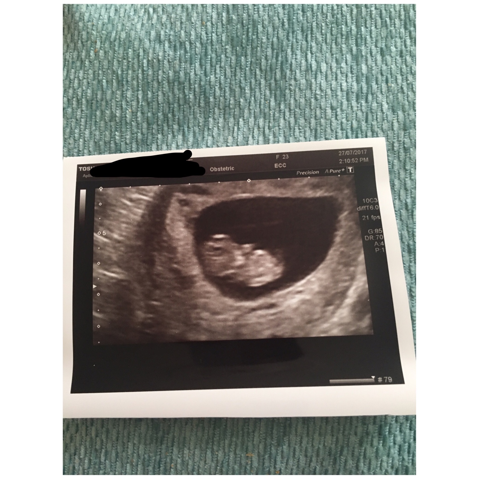 9 week scan