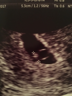 Private early scan 7 weeks