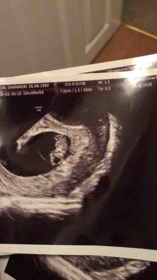Terrified I've had a missed miscarriage!