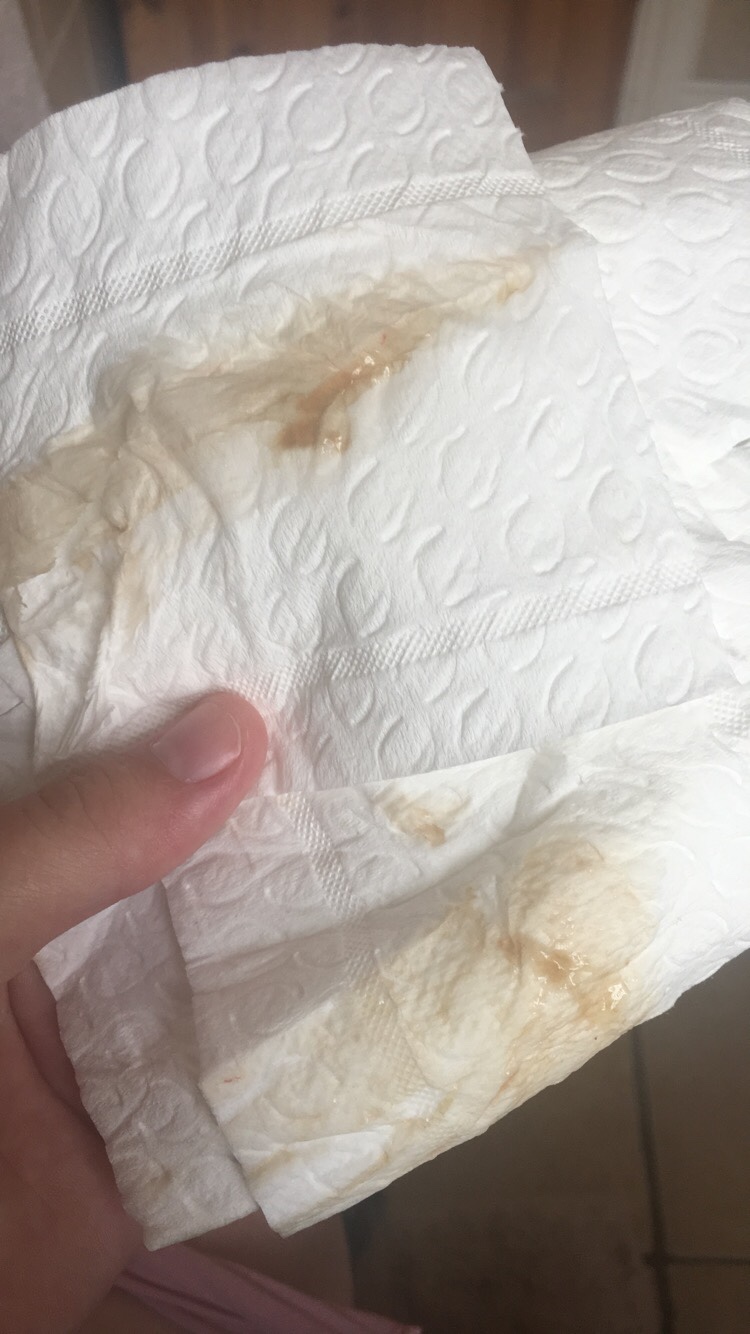 Yellow Mucus Plug TMI Is This My Mucus Plug? | Mumsnet