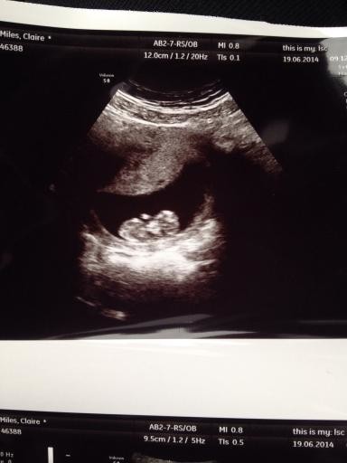 Early scan pics :)