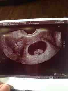 8 week scan today@)!...anyone gt 8 week scan pics???