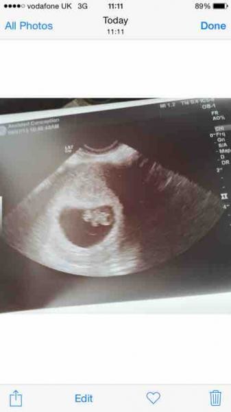 8 week scan today@)!...anyone gt 8 week scan pics???