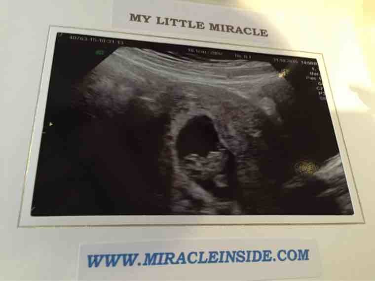 8 week scan today@)!...anyone gt 8 week scan pics???