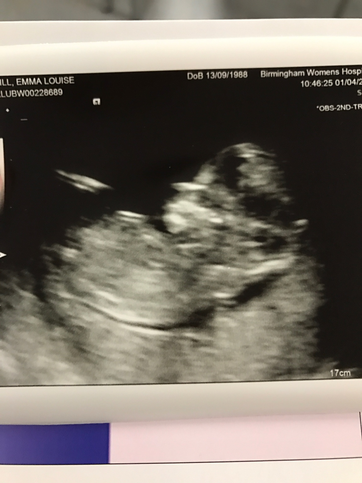 12 week scan Tuesday anyone else?