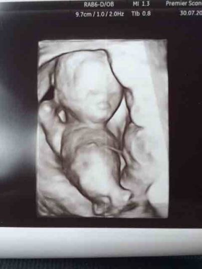 16 weeks 4D scans?