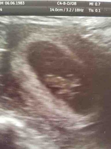 Scan at 9 weeks?