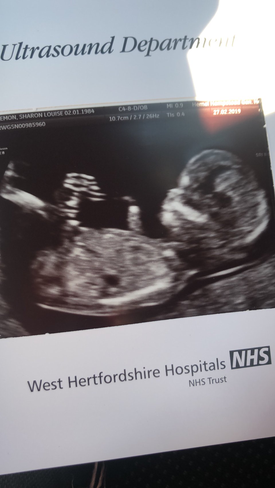 Early gender scan at weekend what do people think?