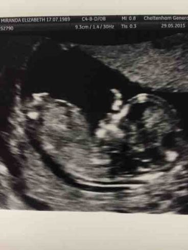 NHS 12 week scan today more nervous then my private one!!!