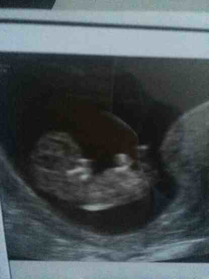 NHS 12 week scan today more nervous then my private one!!!