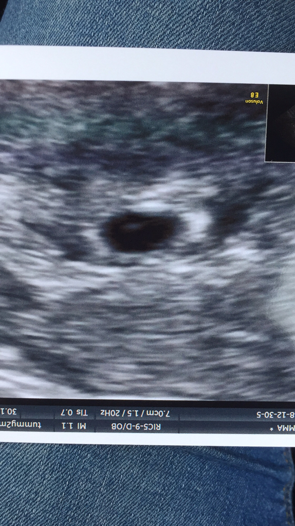 Early scan!