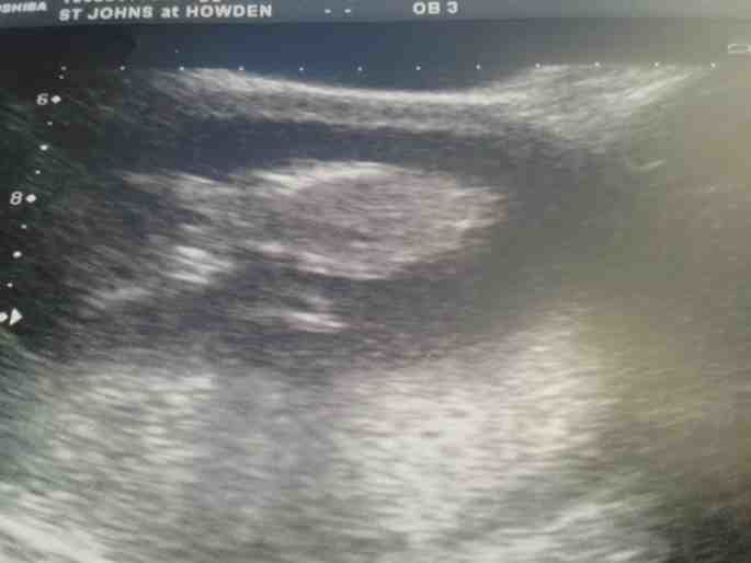 Scan this morning!!!