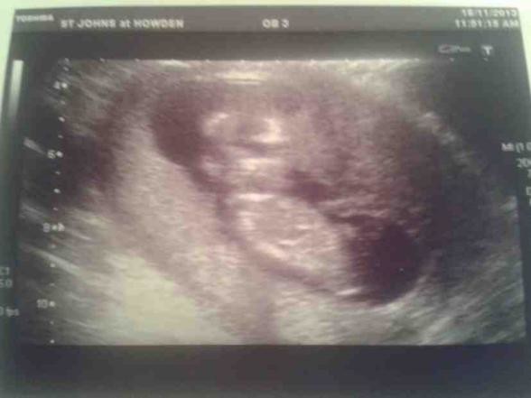 Scan this morning!!!