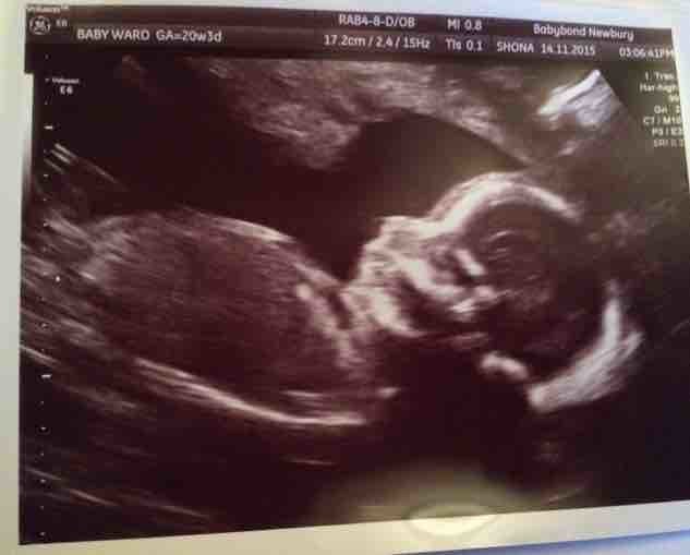 Any 12 week scans girls?!