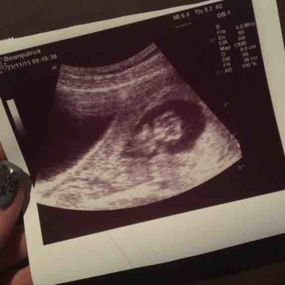 Any 12 week scans girls?!