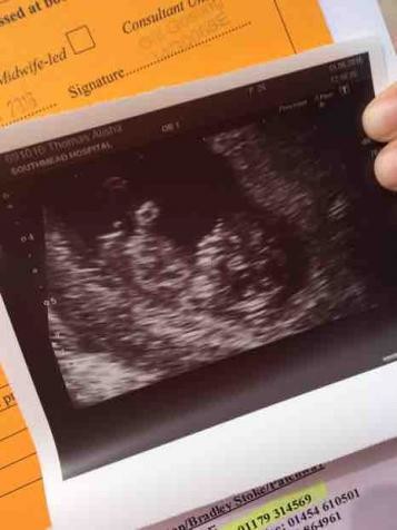 12 week scan .. early