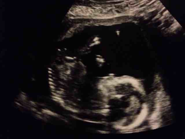 16 week scan