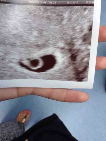 What can you see on 6 week scan?