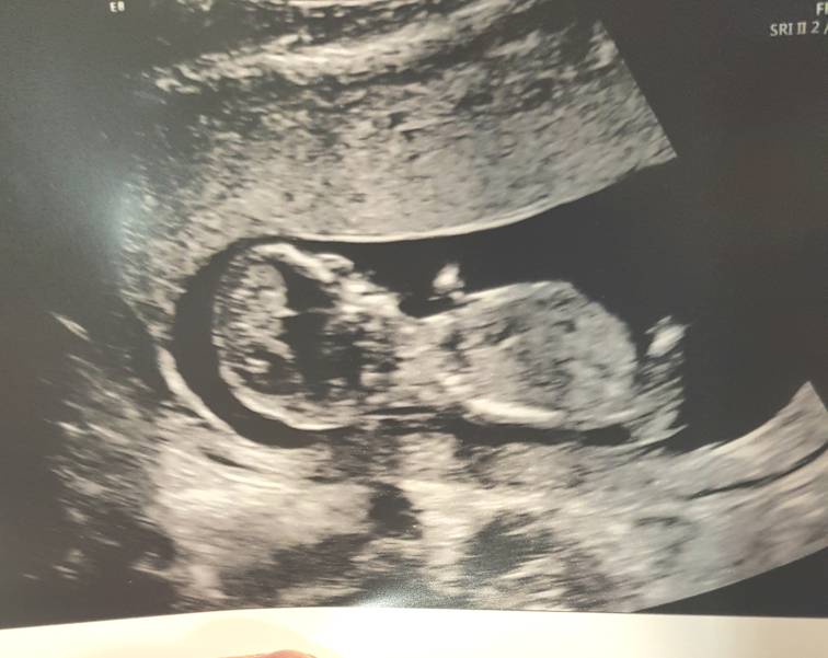 Let me see your early scan pictures