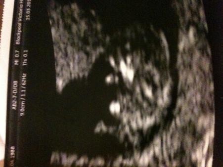 9 plus 6 scan picture