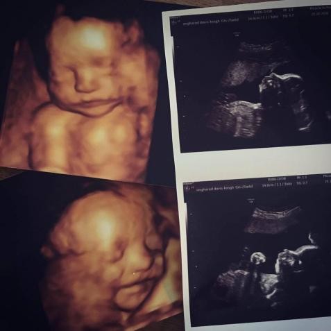 Share your 3D scans :)