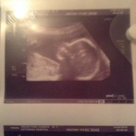 Due date and scan pics